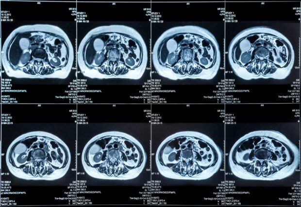 Clinica RMN Bucuresti - BIOMED SCAN