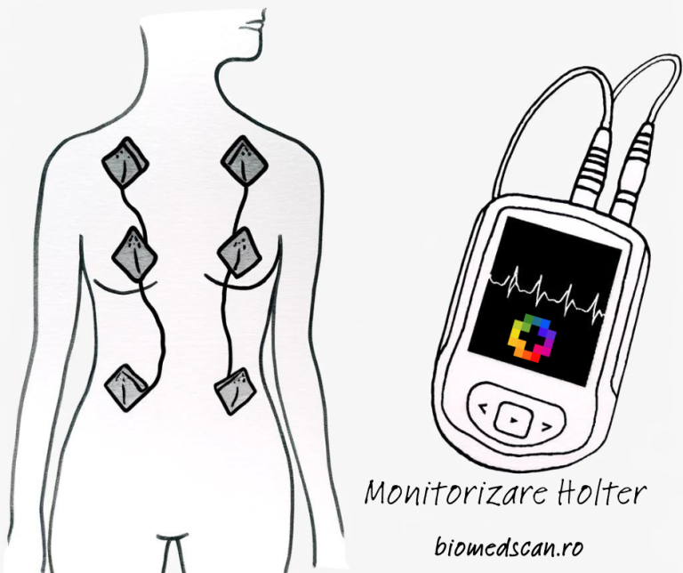 Monitorizare Holter EKG | Preț, Durata, Pregatire