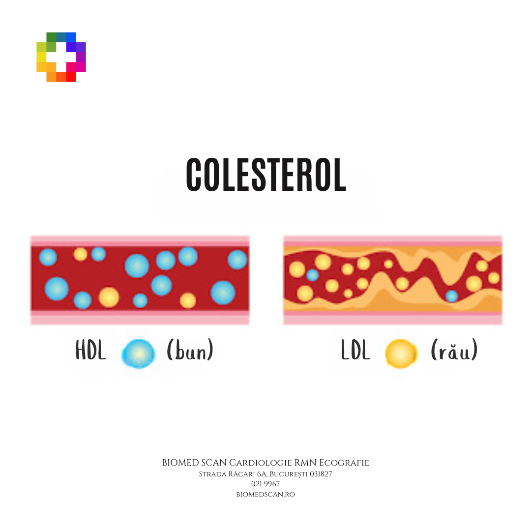 Colesterol LDL marit 🆚 Hipercolesterolemie